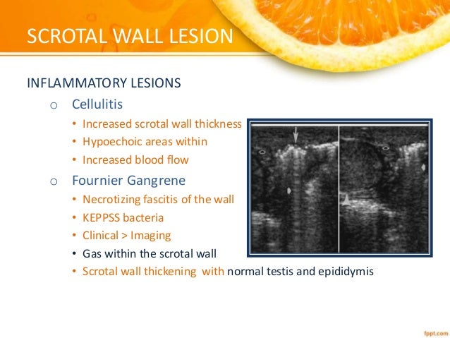 Imaging of the scrotum