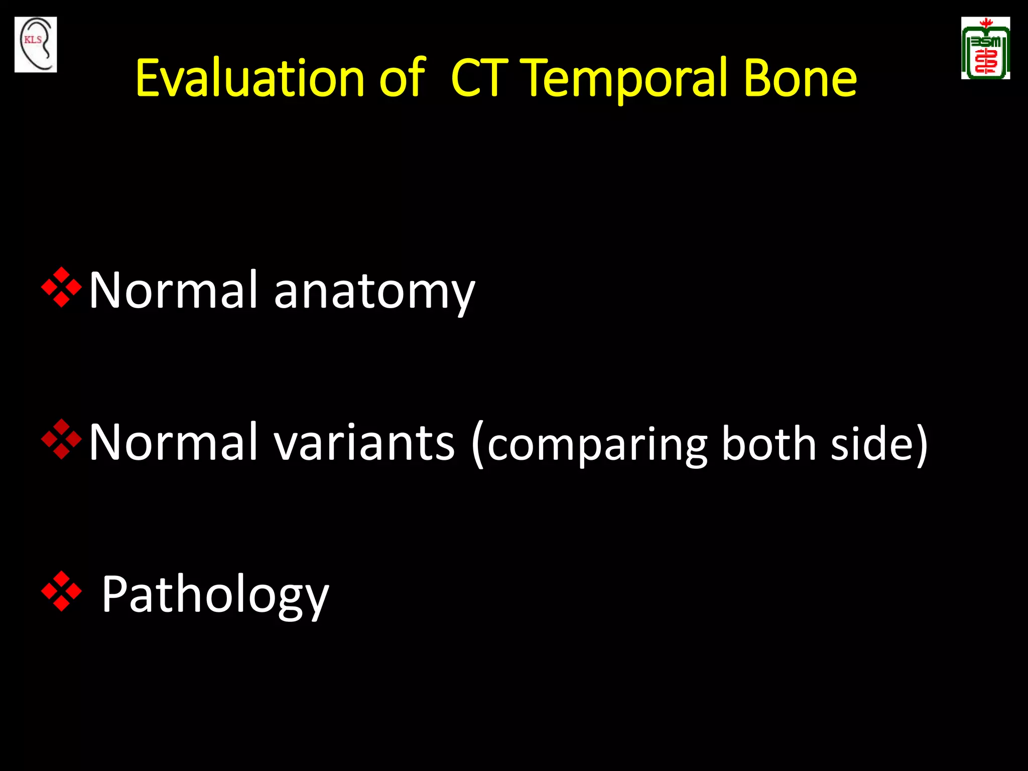 Imaging of the temporal bone | PPTX