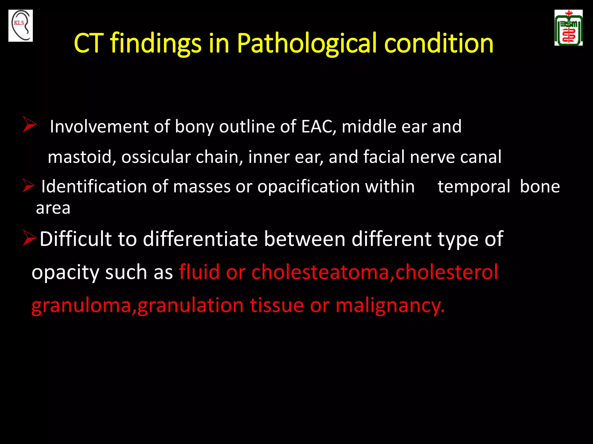 Imaging of the temporal bone | PPTX