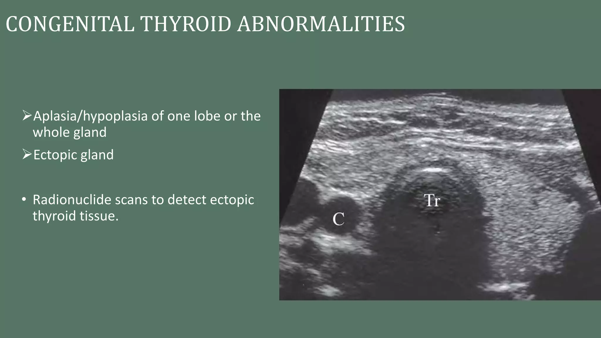 Imaging of thyroid | PPTX