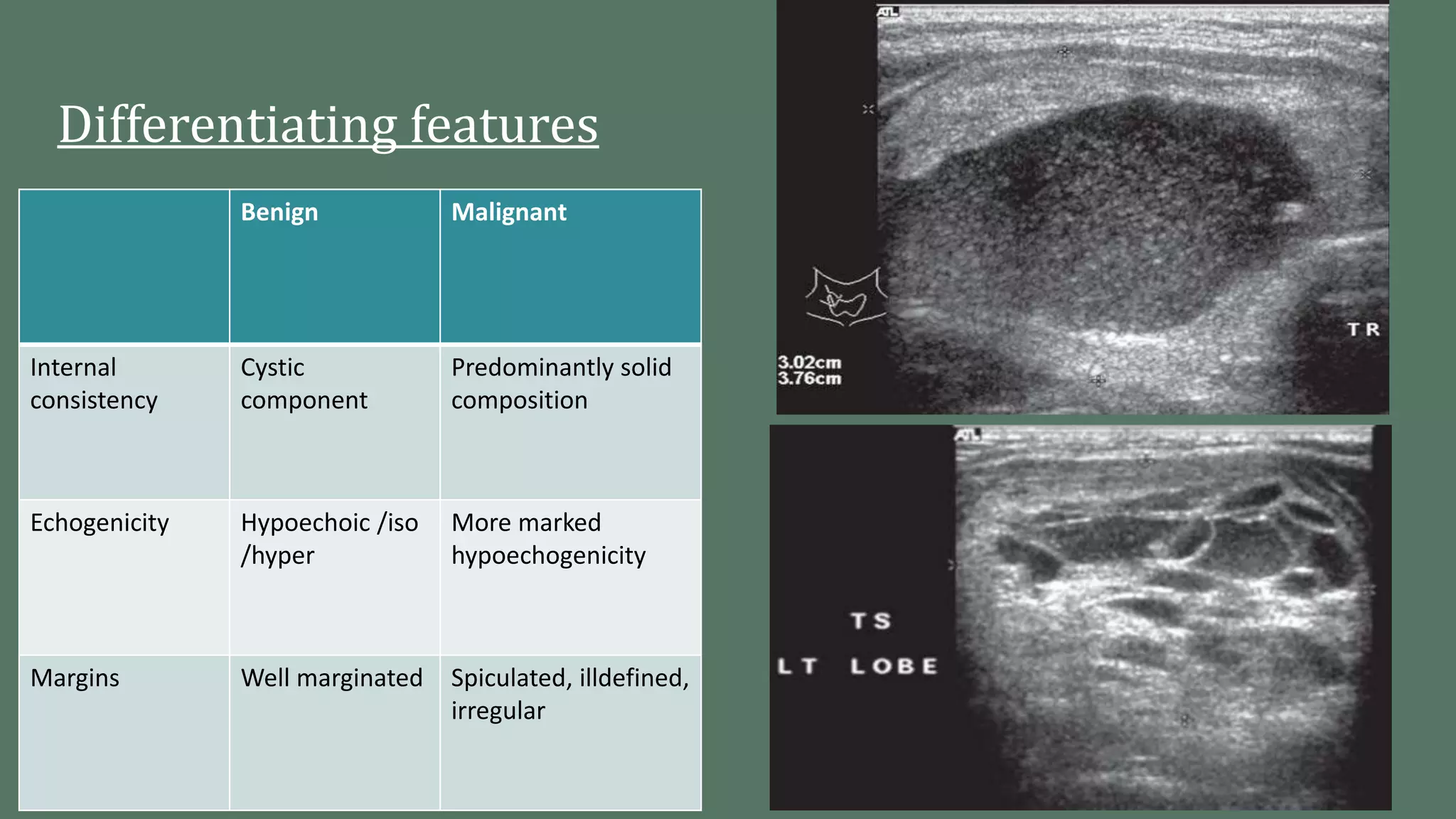 Imaging of thyroid | PPTX