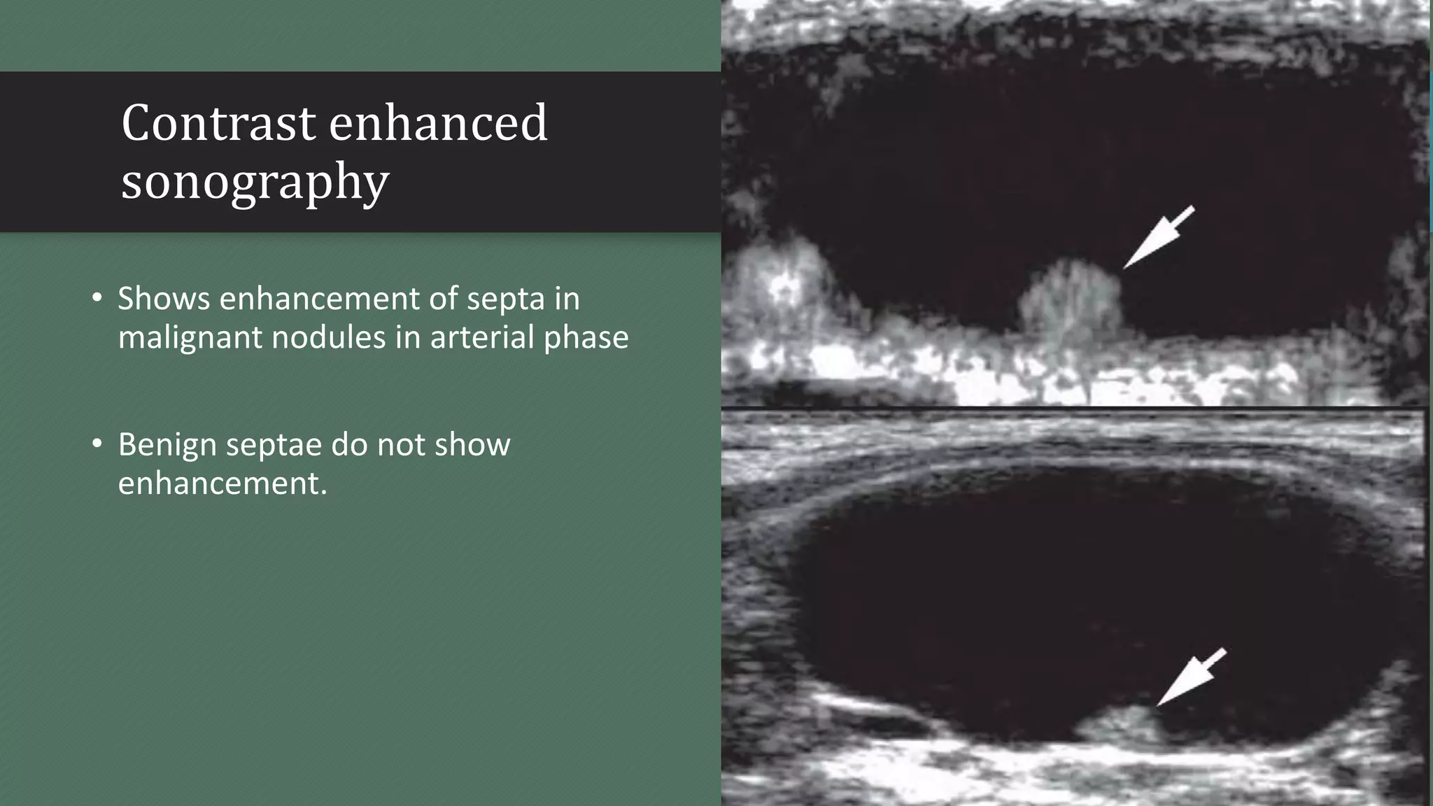 Imaging of thyroid | PPTX
