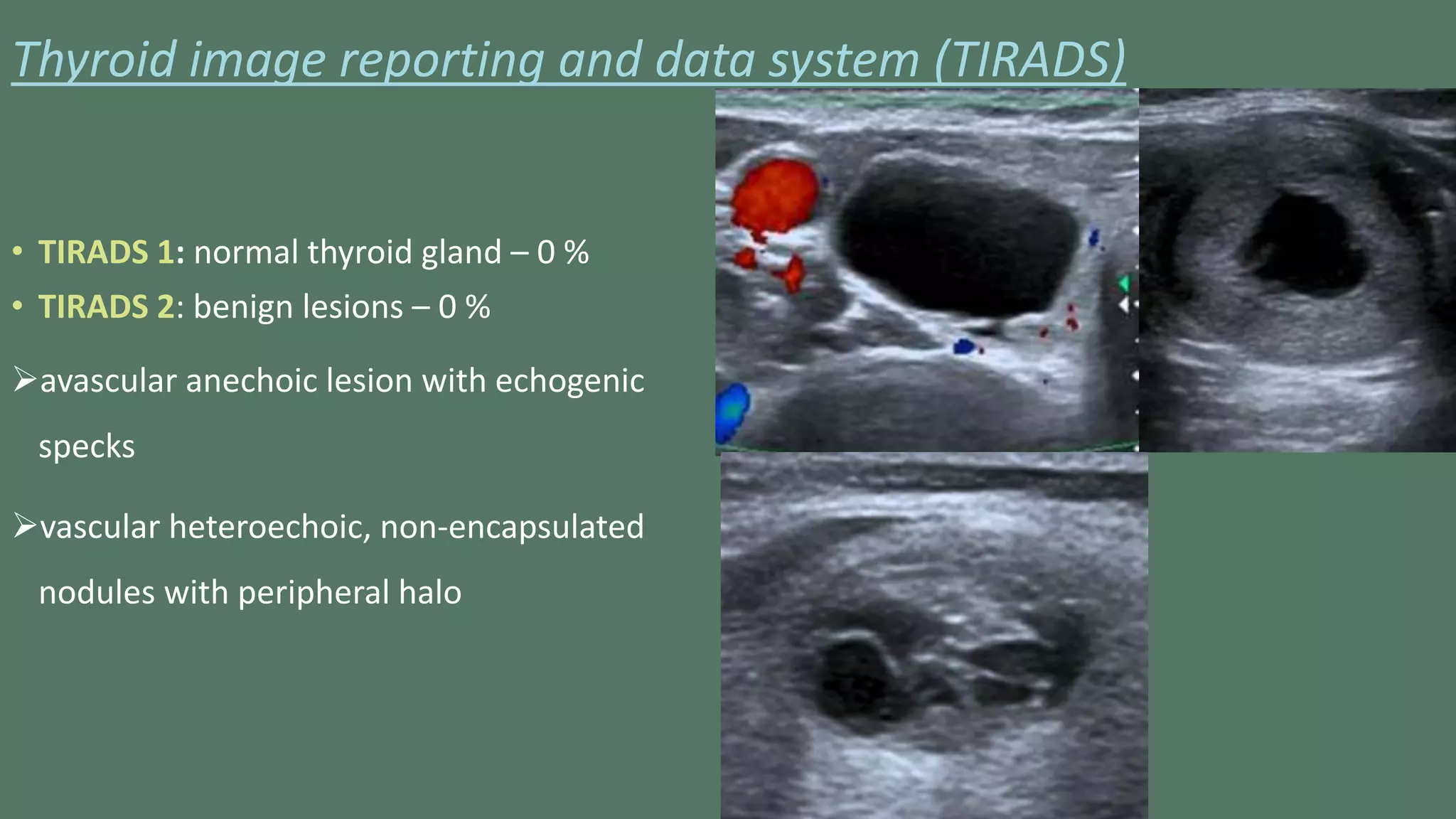 Imaging of thyroid | PPTX