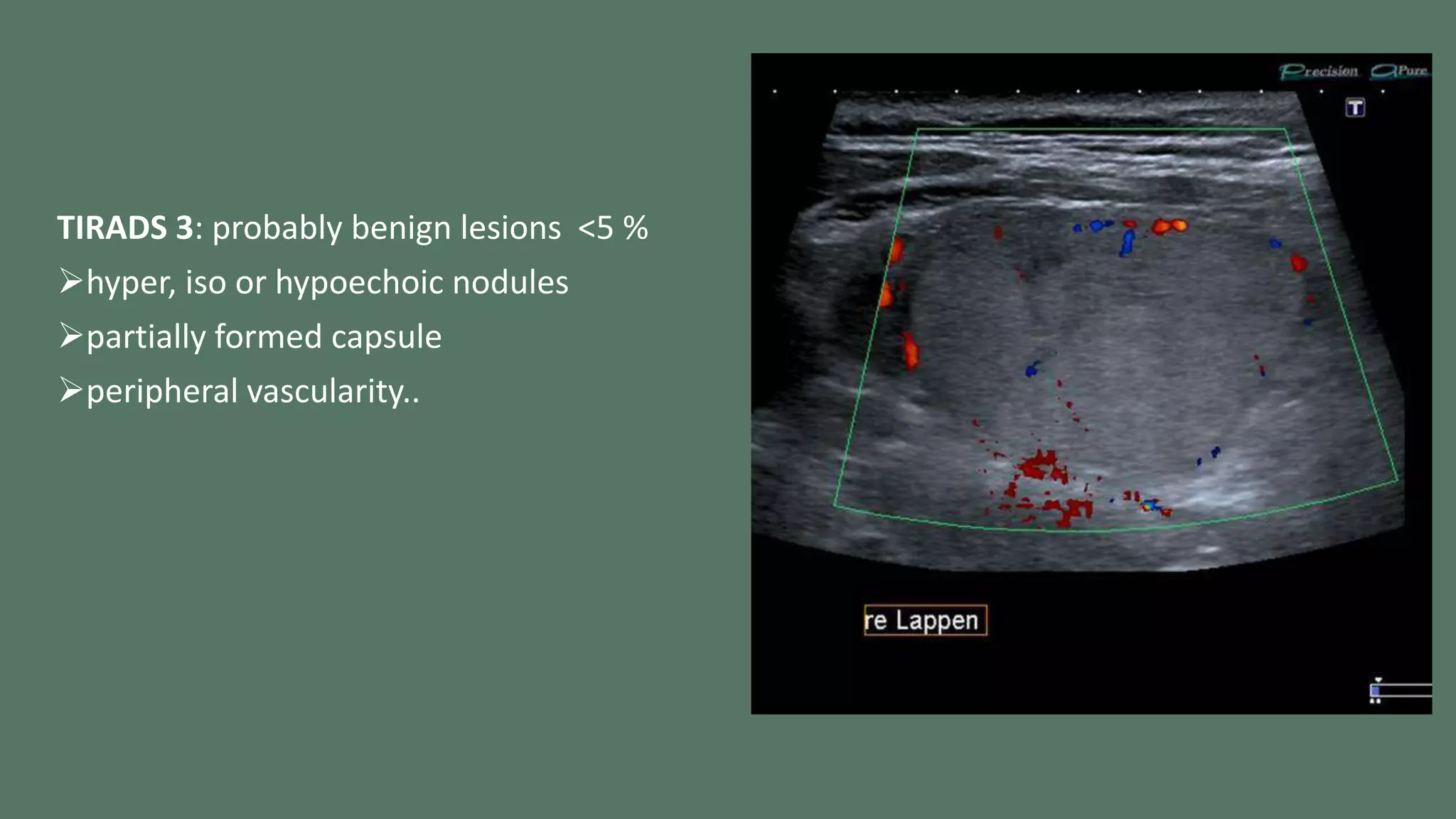 Imaging of thyroid | PPTX