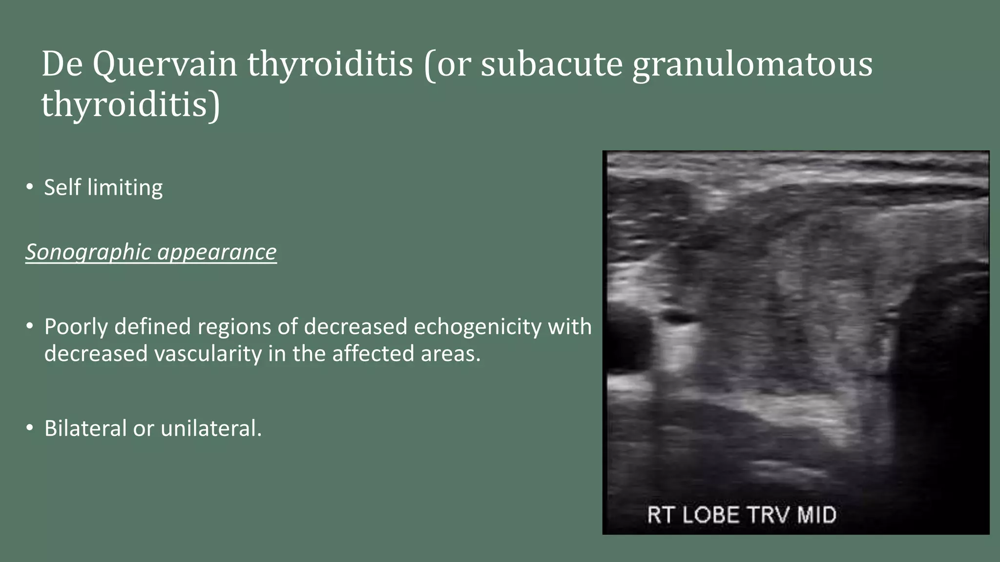 Imaging of thyroid | PPTX