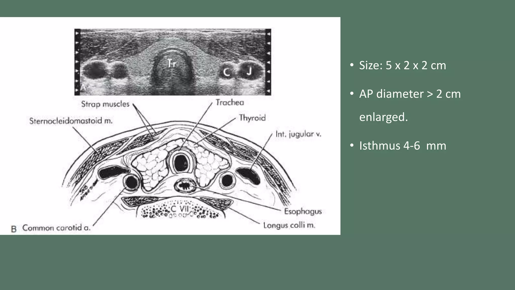 Imaging of thyroid | PPTX