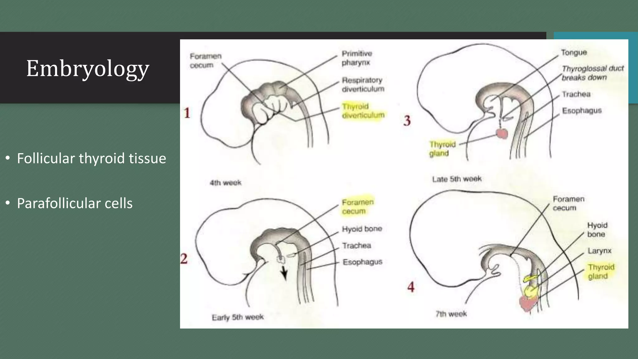 Imaging of thyroid | PPTX