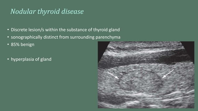 Imaging of thyroid | PPTX | Thyroid Disorders | Endocrine and Metabolic ...