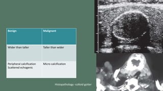 Imaging of thyroid | PPTX