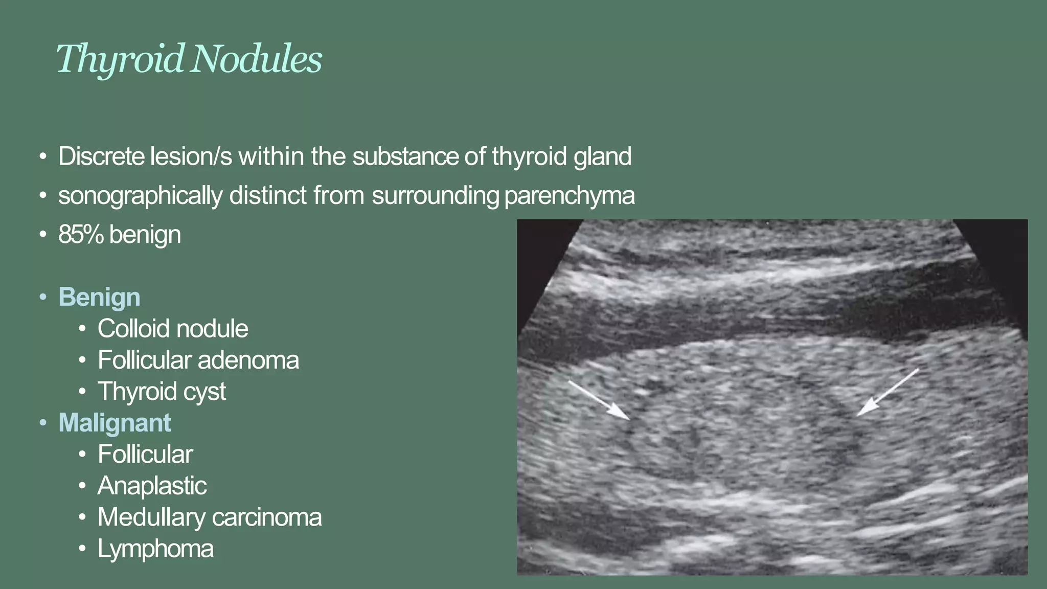 Imaging Of Thyroid Lesions Pptx Thyroid Disorders Endocrine And Metabolic Diseases