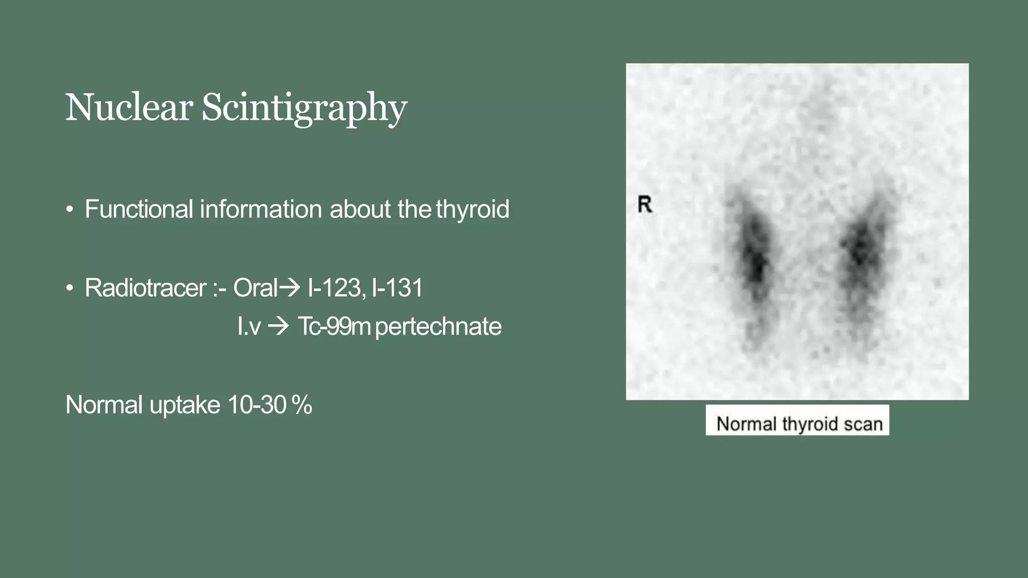 Imaging Of Thyroid Lesions Pptx Thyroid Disorders Endocrine And Metabolic Diseases