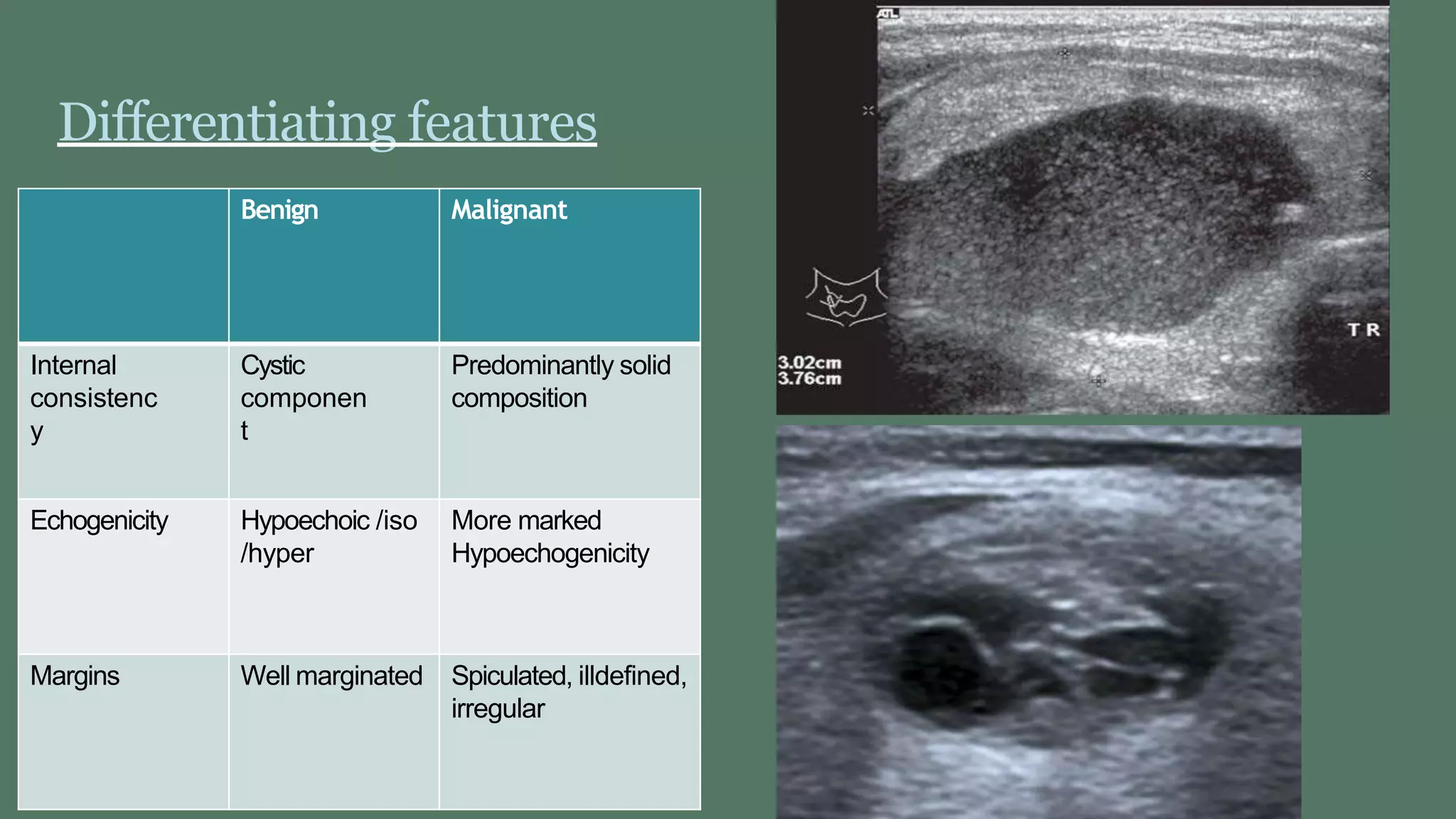 Imaging of Thyroid Lesions.pptx | Thyroid Disorders | Endocrine and Metabolic Diseases