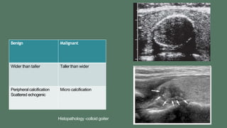 Imaging of Thyroid Lesions.pptx