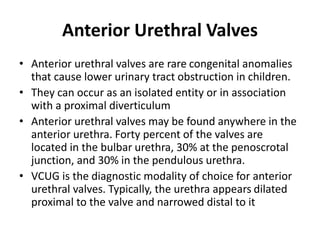 Anterior Urethral Valves