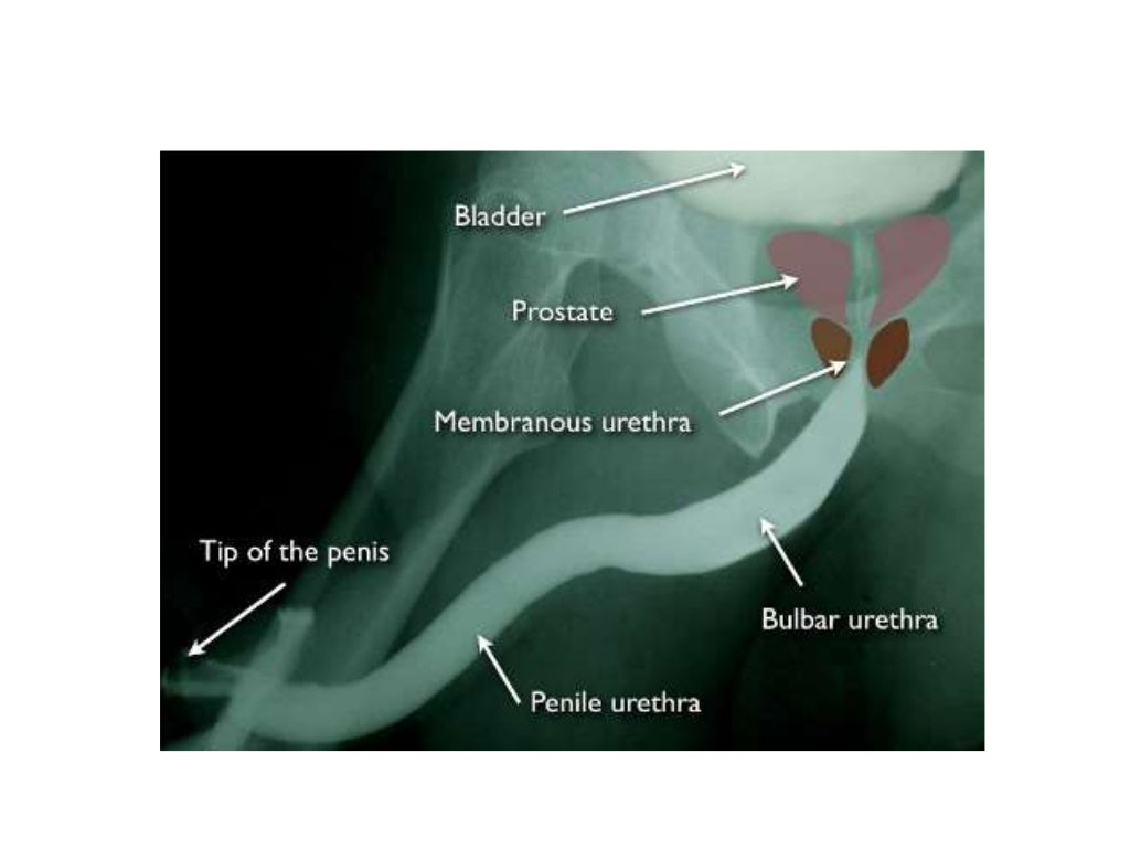 Imaging of urethral pathologies