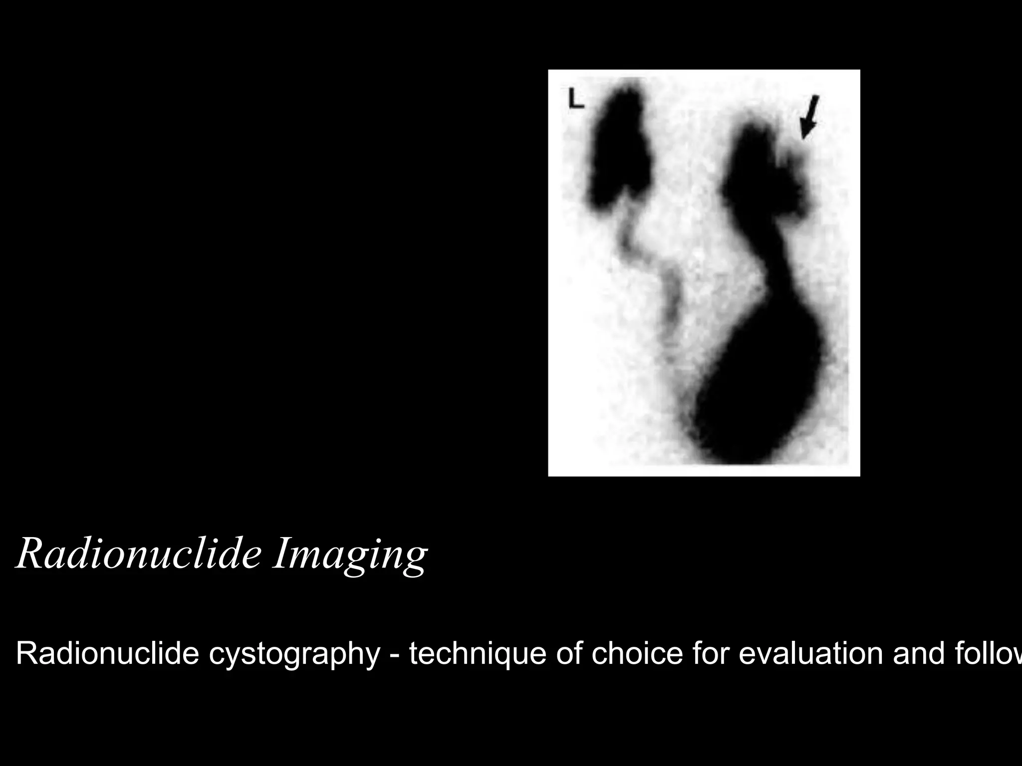 Imaging of urinary bladder and urethra | PPTX