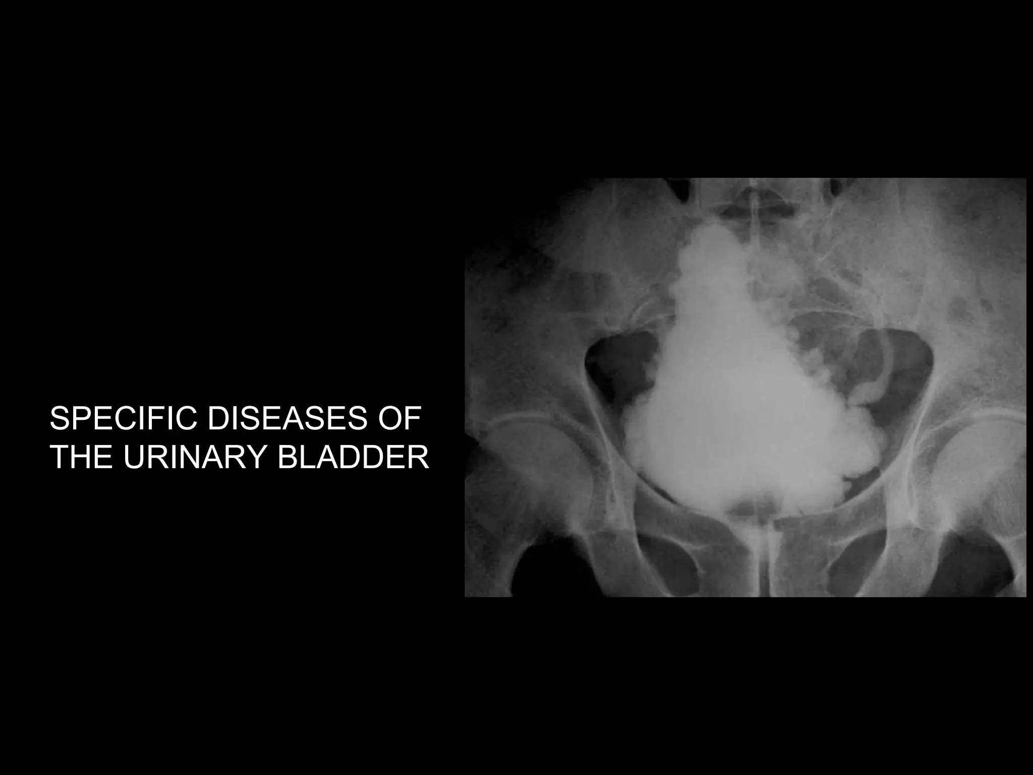 Imaging of urinary bladder and urethra | PPTX