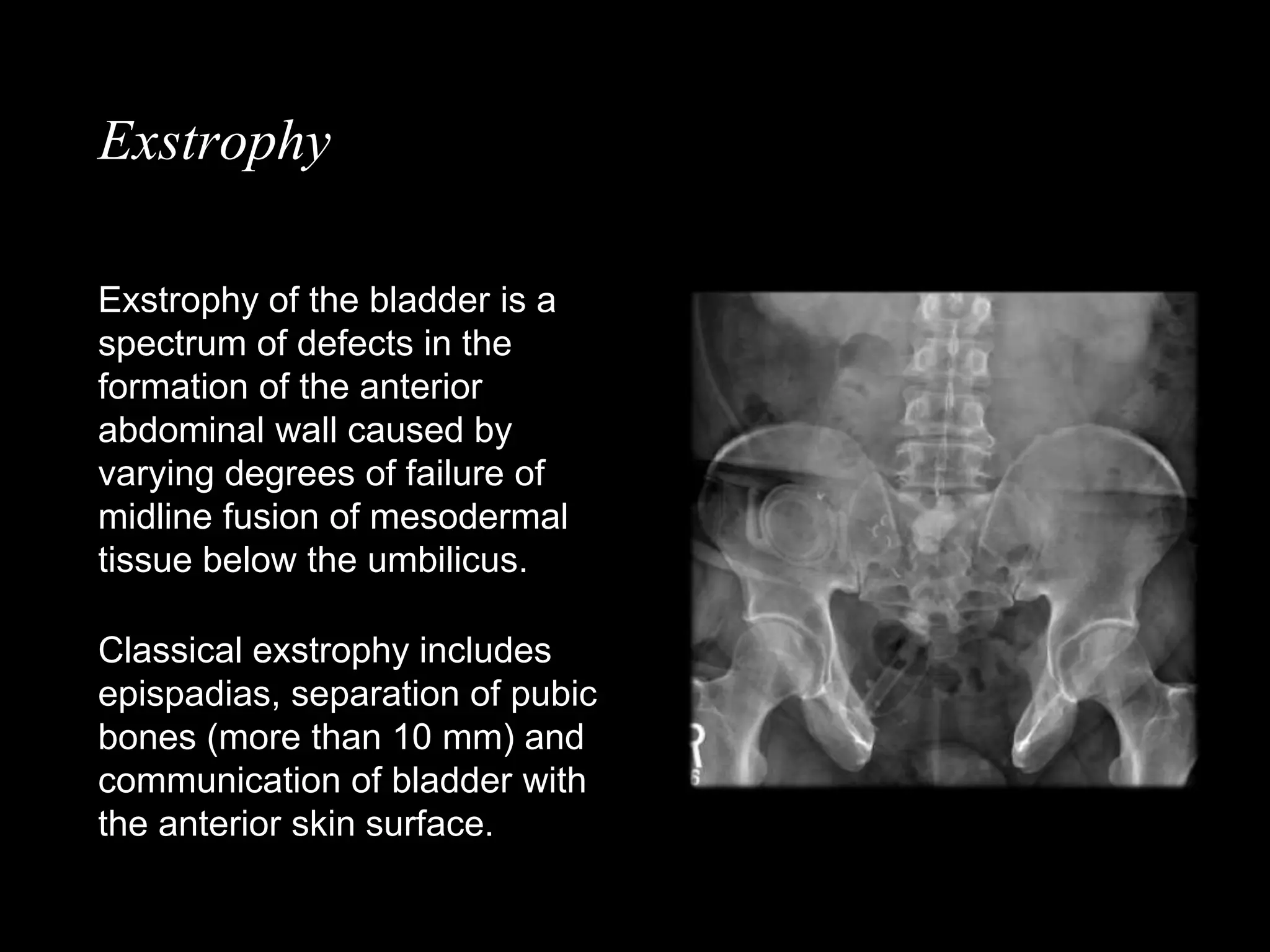 Imaging of urinary bladder and urethra | PPTX
