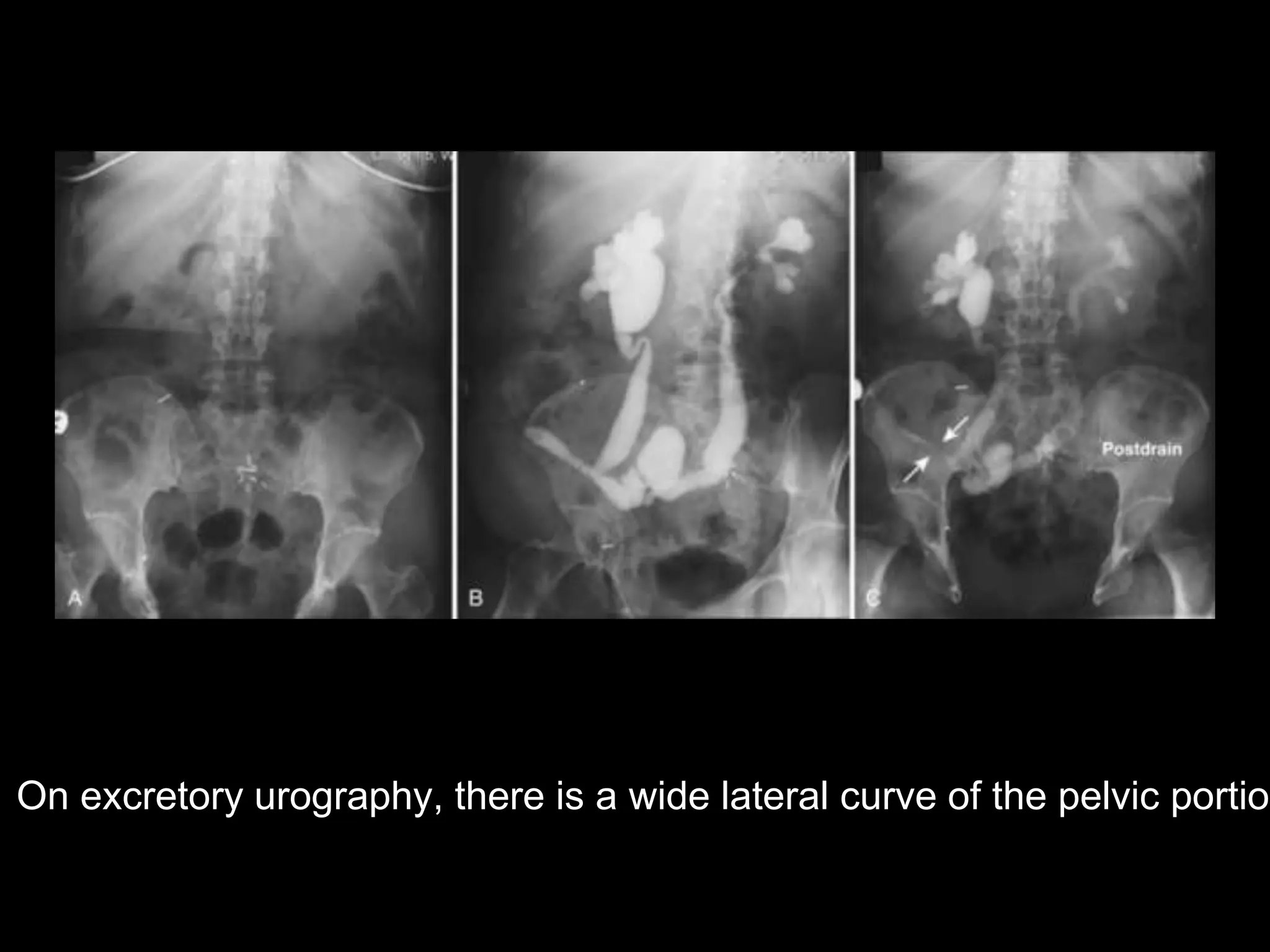 Imaging of urinary bladder and urethra | PPTX