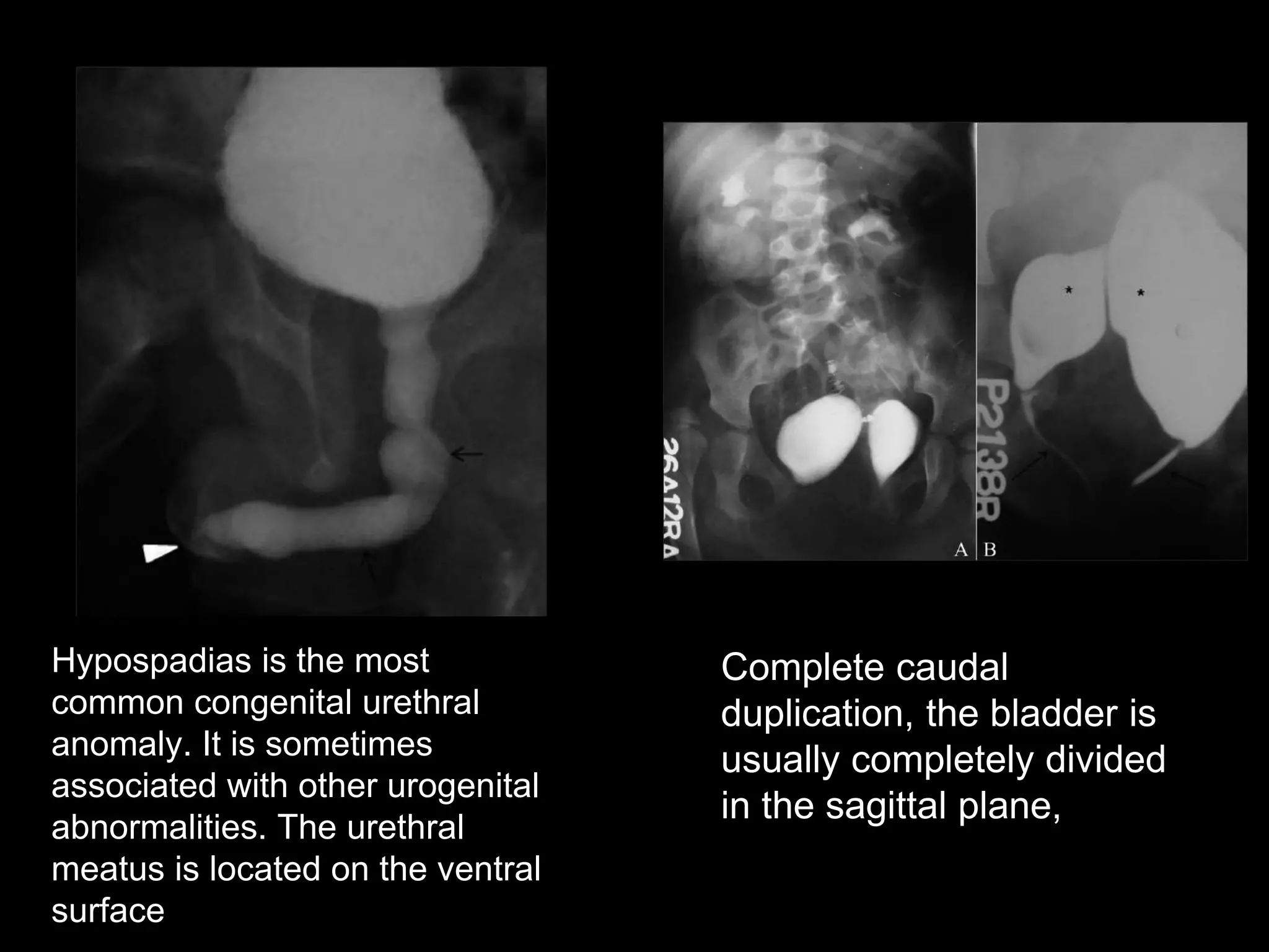 Imaging of urinary bladder and urethra | PPTX | Medical Tests | Medical ...