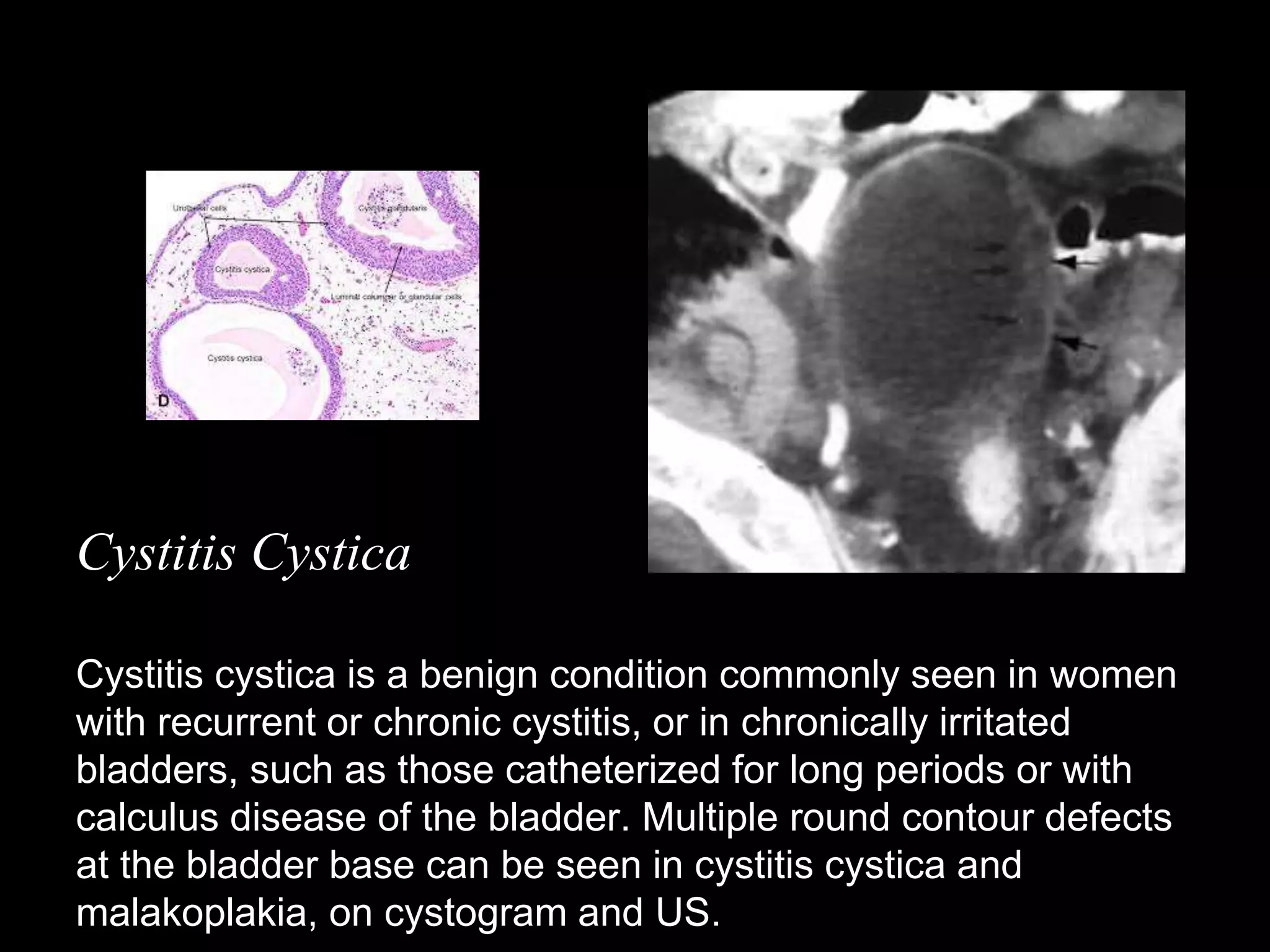 Imaging of urinary bladder and urethra | PPTX