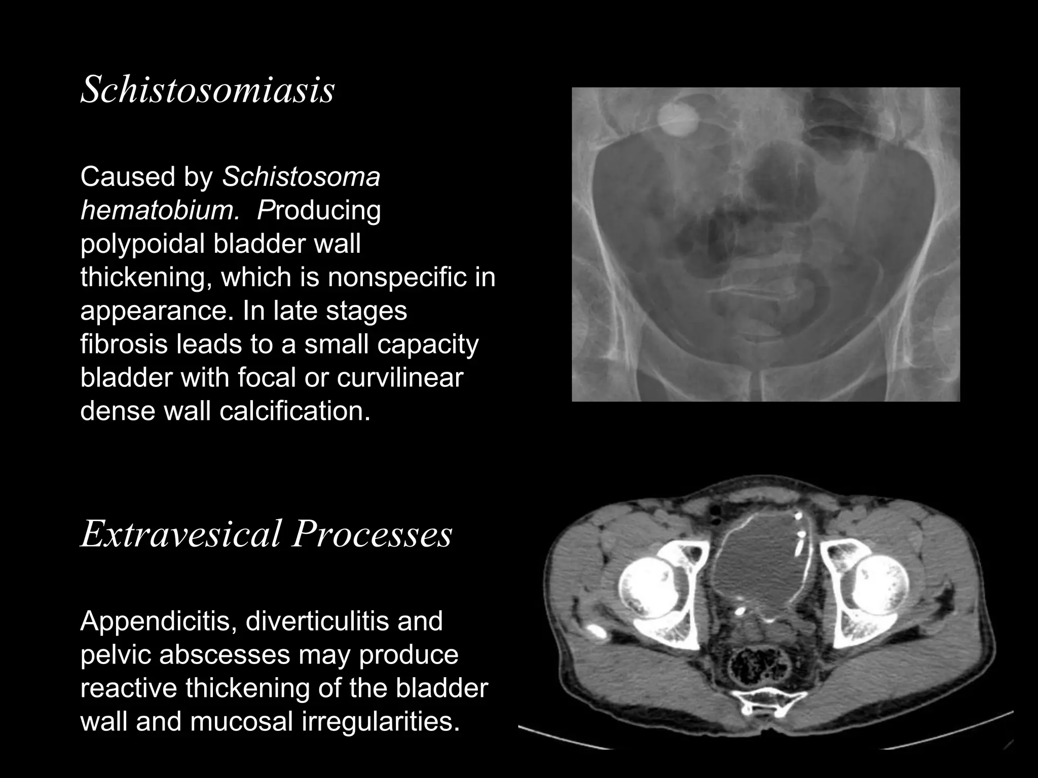 Imaging of urinary bladder and urethra | PPTX