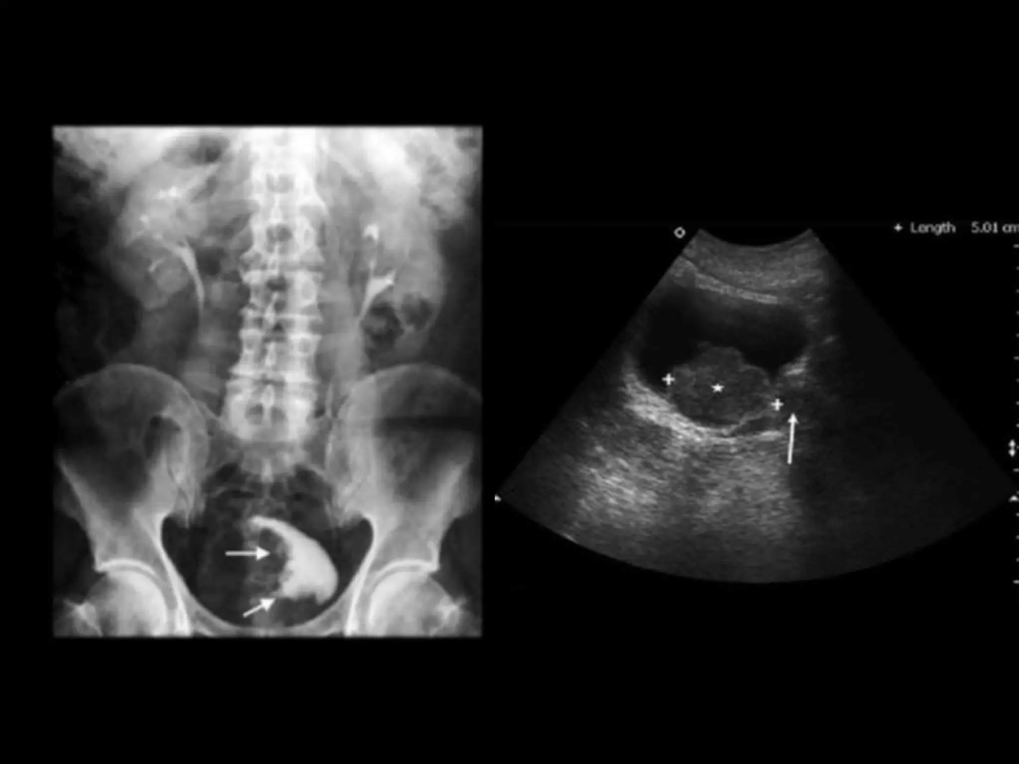 Imaging of urinary bladder and urethra | PPTX