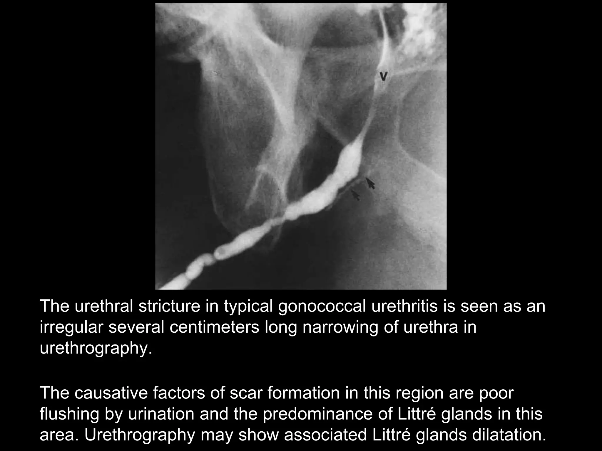 Imaging of urinary bladder and urethra | PPTX