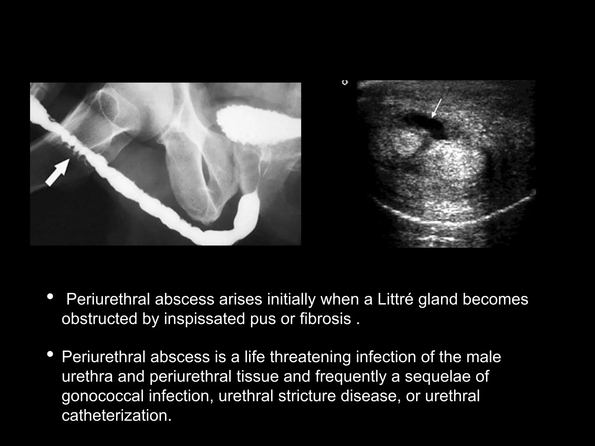 Imaging of urinary bladder and urethra | PPTX
