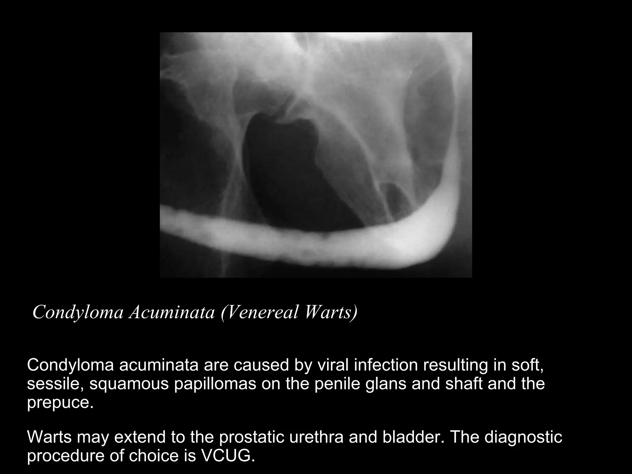 Imaging of urinary bladder and urethra | PPTX