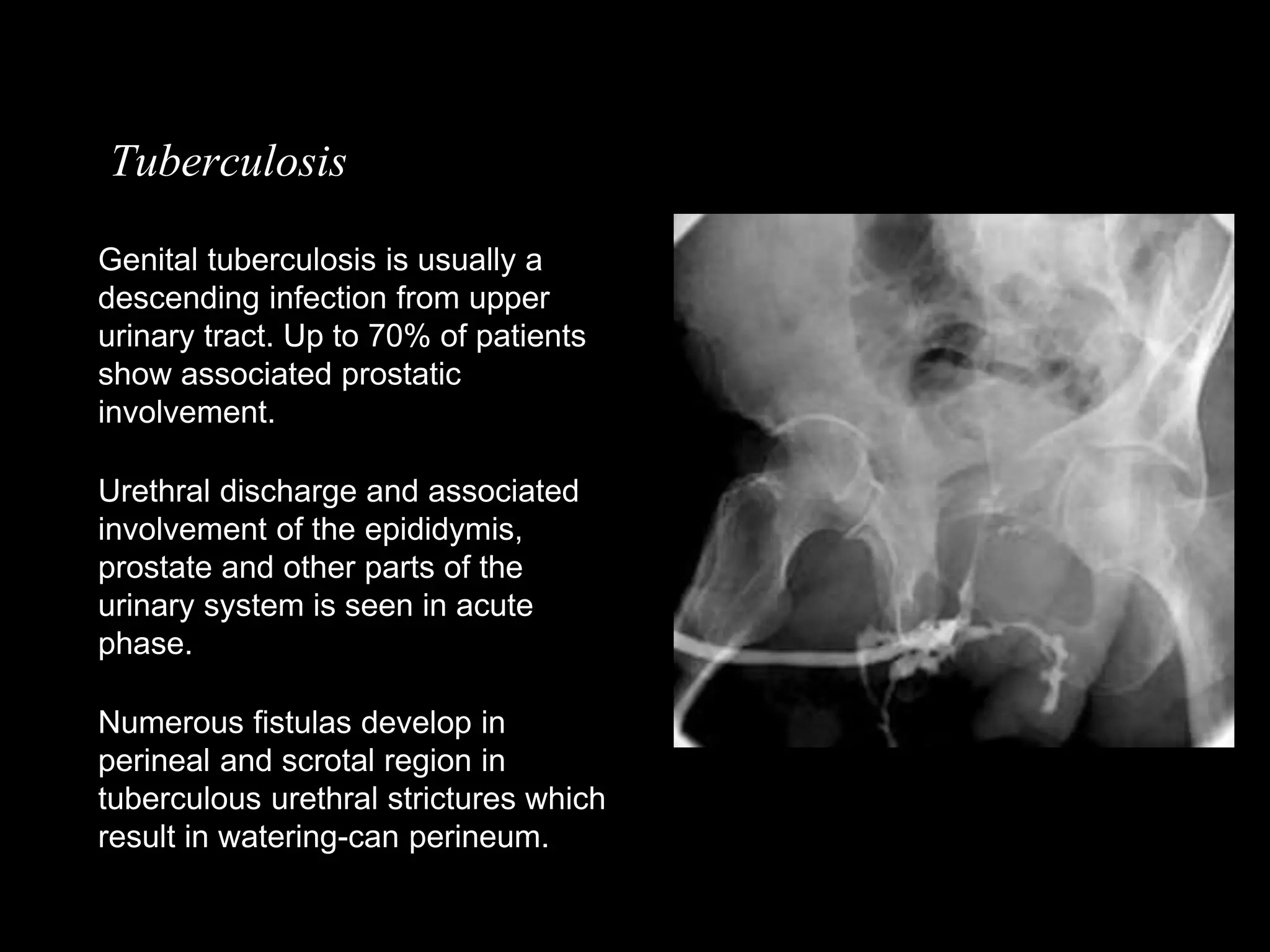 Imaging of urinary bladder and urethra | PPTX