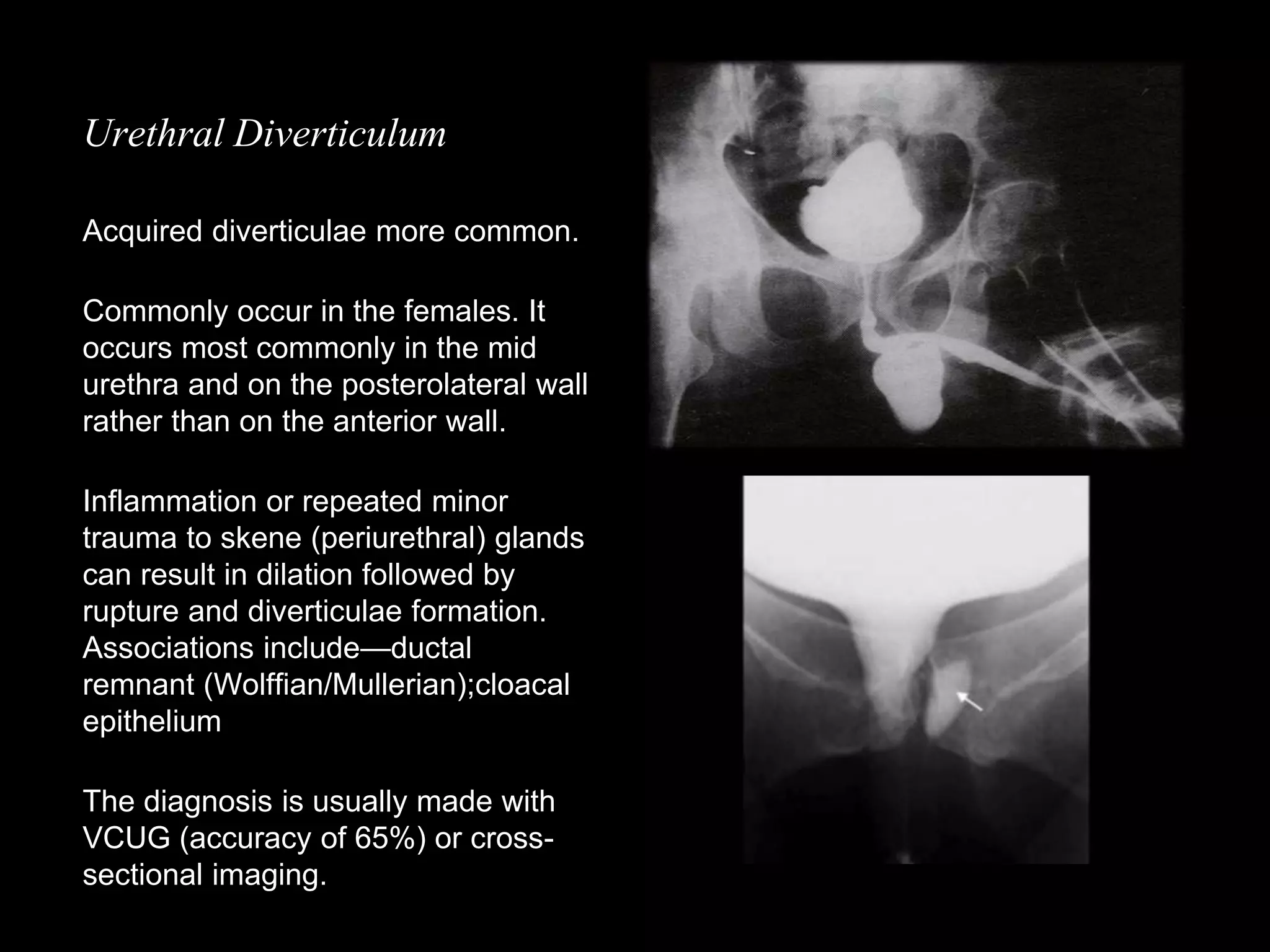 Imaging of urinary bladder and urethra | PPTX