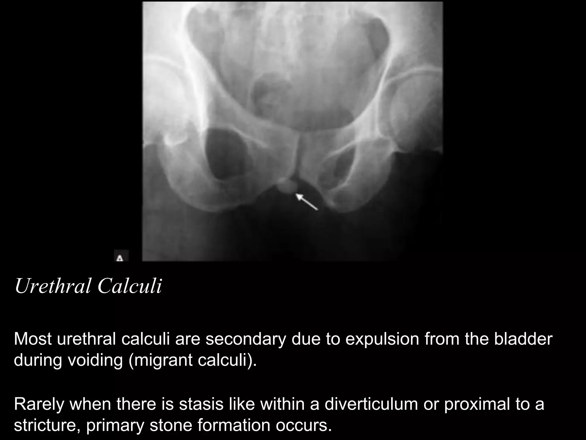 Imaging of urinary bladder and urethra | PPTX