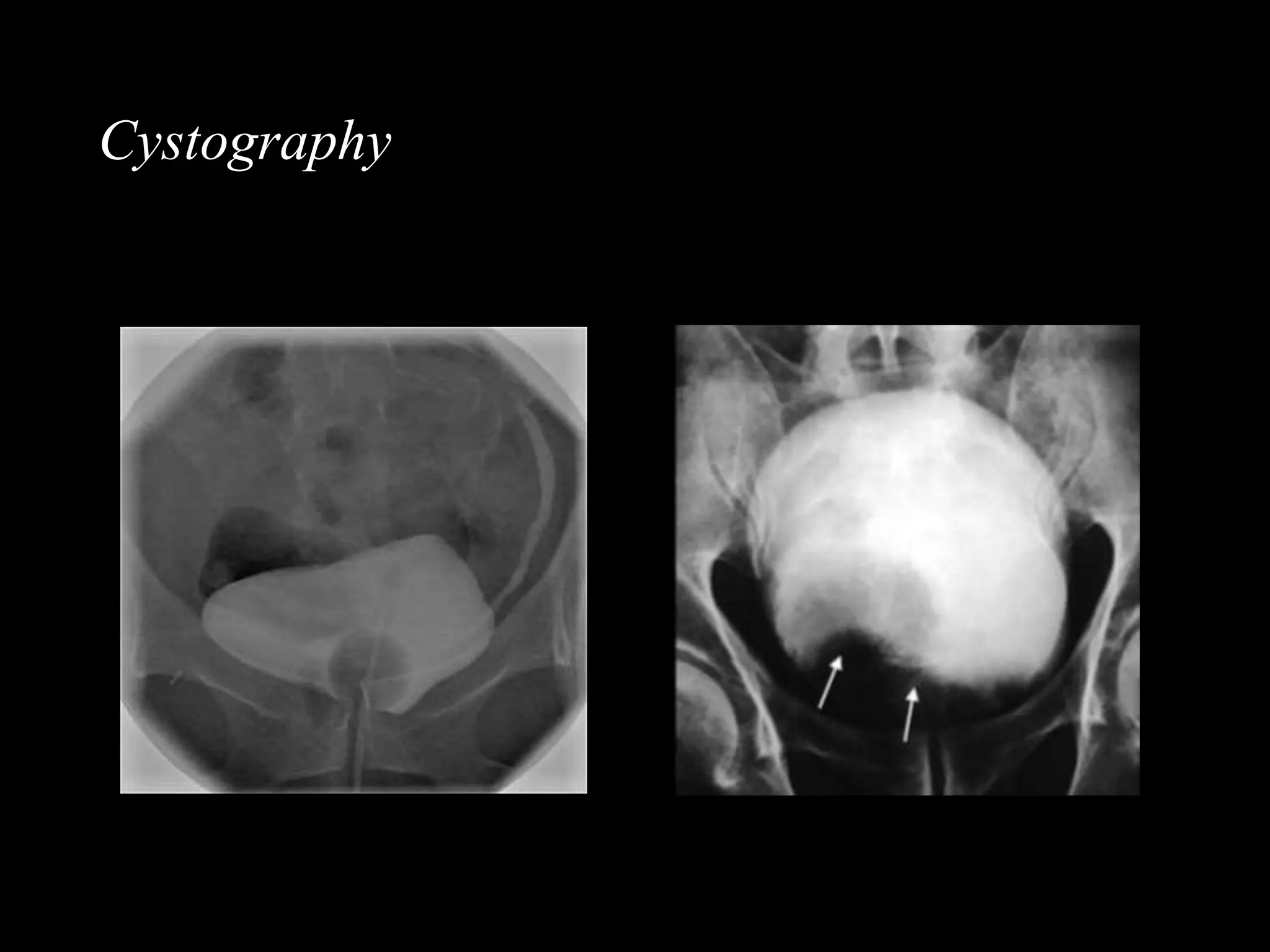 Imaging of urinary bladder and urethra | PPTX