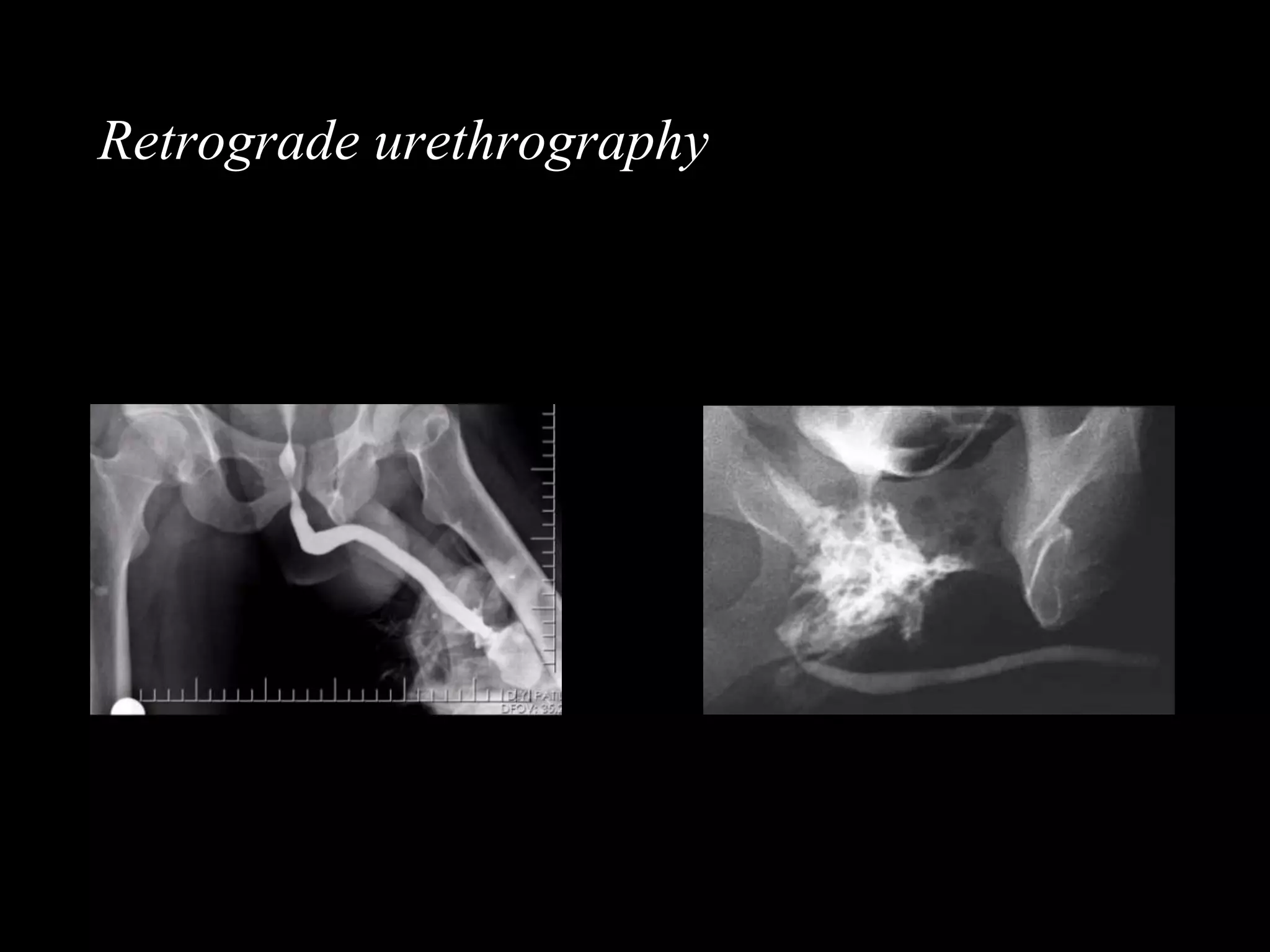 Imaging of urinary bladder and urethra | PPTX | Medical Tests | Medical ...