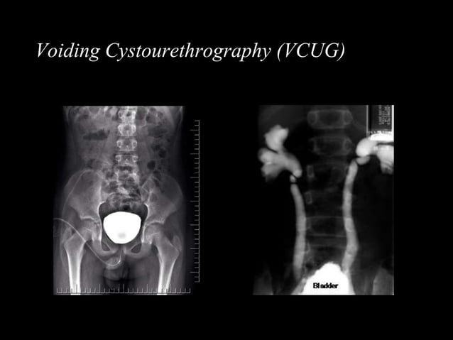 Imaging of urinary bladder and urethra | PPTX | Medical Tests | Medical ...