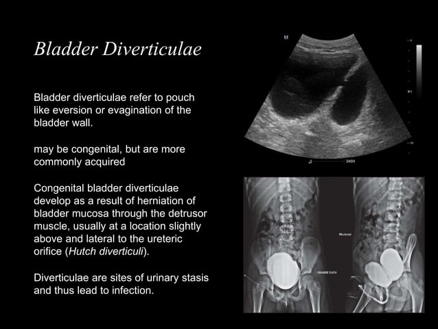 Imaging of urinary bladder and urethra | PPTX | Medical Tests | Medical ...