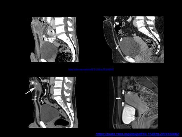 Imaging of urinary bladder and urethra | PPTX | Medical Tests | Medical ...
