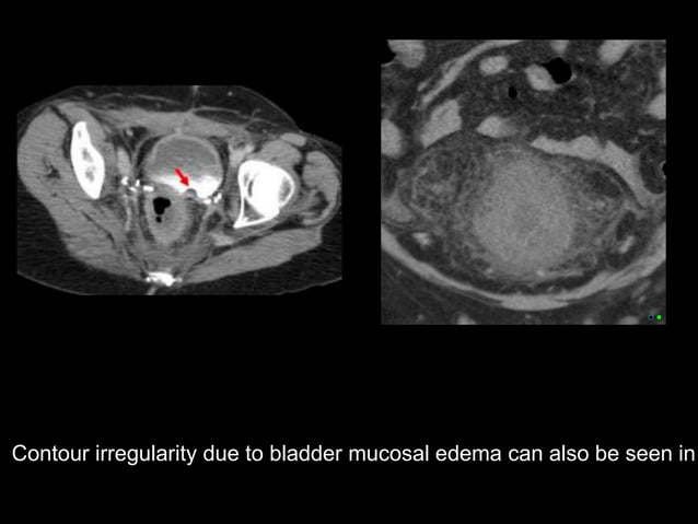 Imaging of urinary bladder and urethra | PPTX | Medical Tests | Medical ...