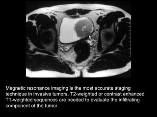 Imaging of urinary bladder and urethra | PPTX
