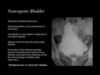 Imaging of urinary bladder and urethra | PPT