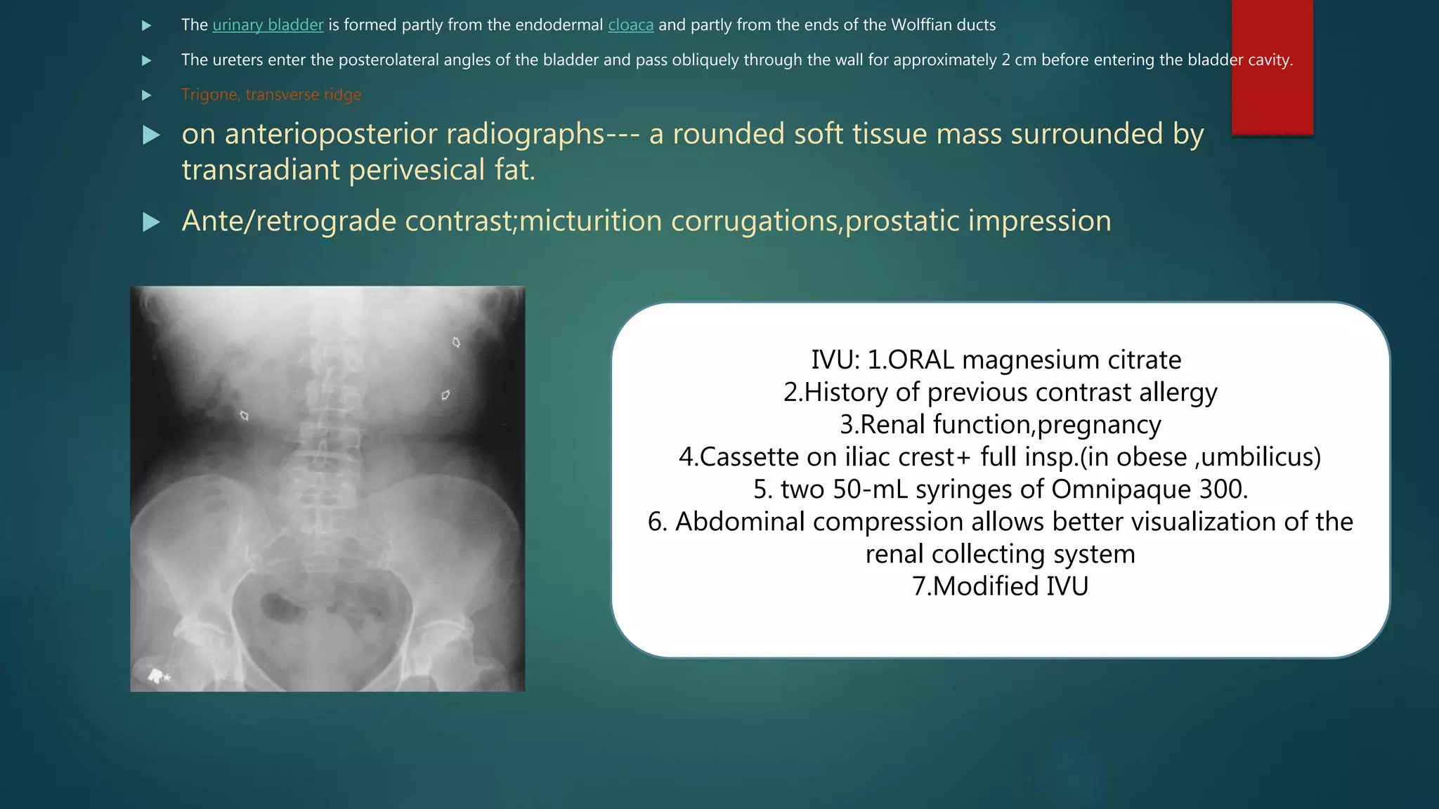 Imaging of urinary bladder malignancy | PPTX