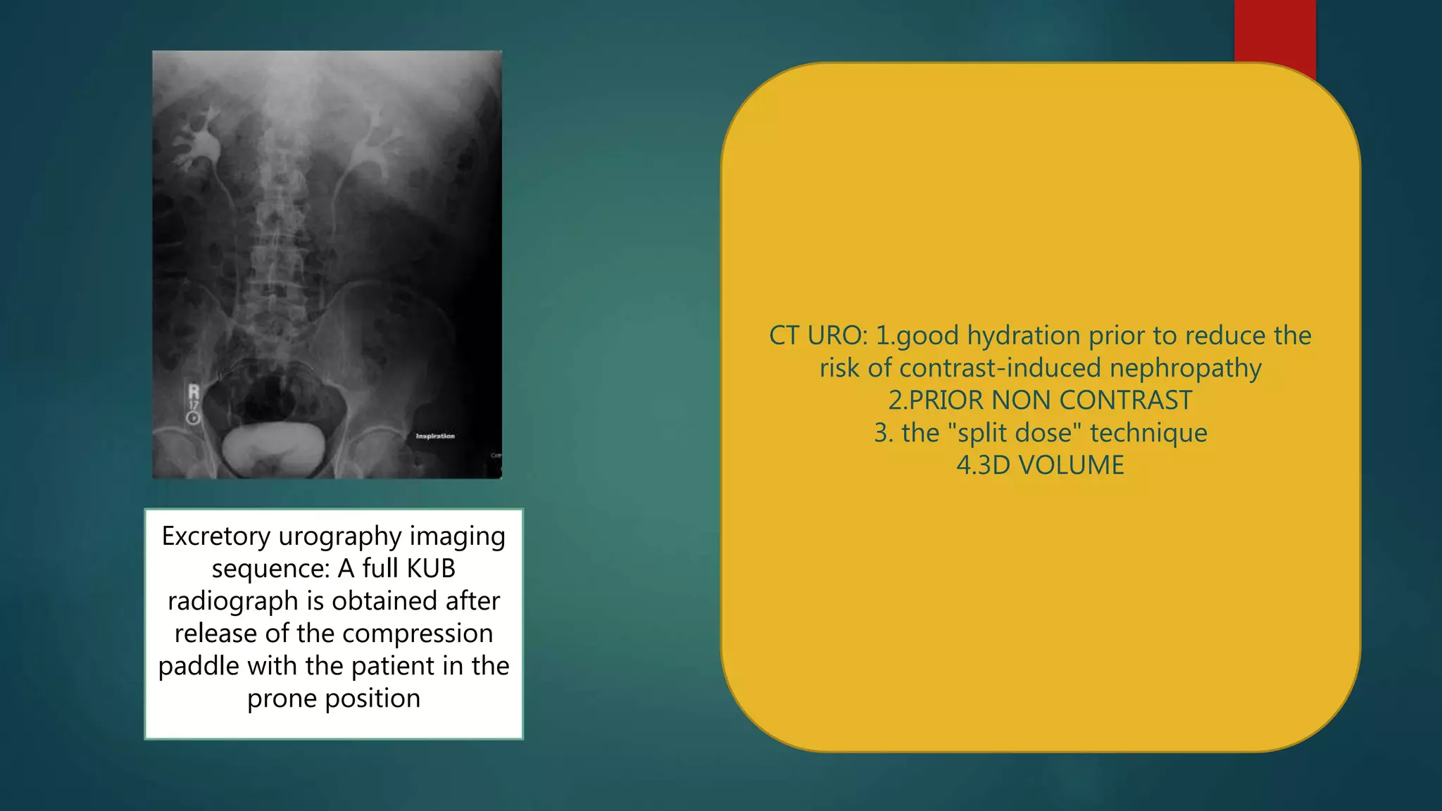 Imaging of urinary bladder malignancy | PPTX