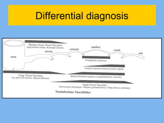 Imaging of vasculitis | PPT