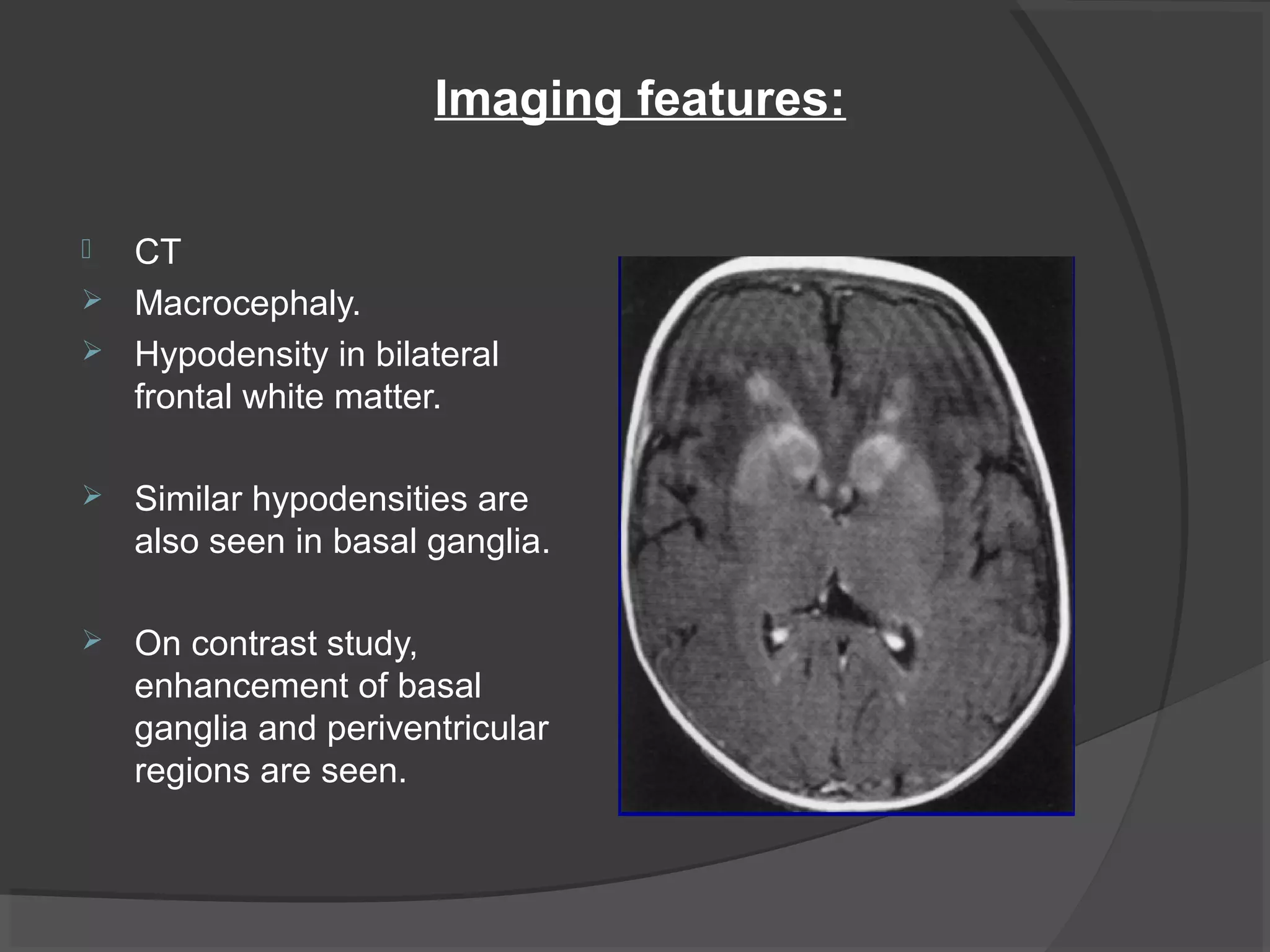 Imaging of white matter diseases | PPT