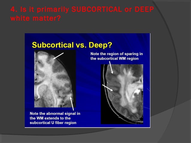 Imaging of white matter diseases | PPT | Brain and Nervous System ...