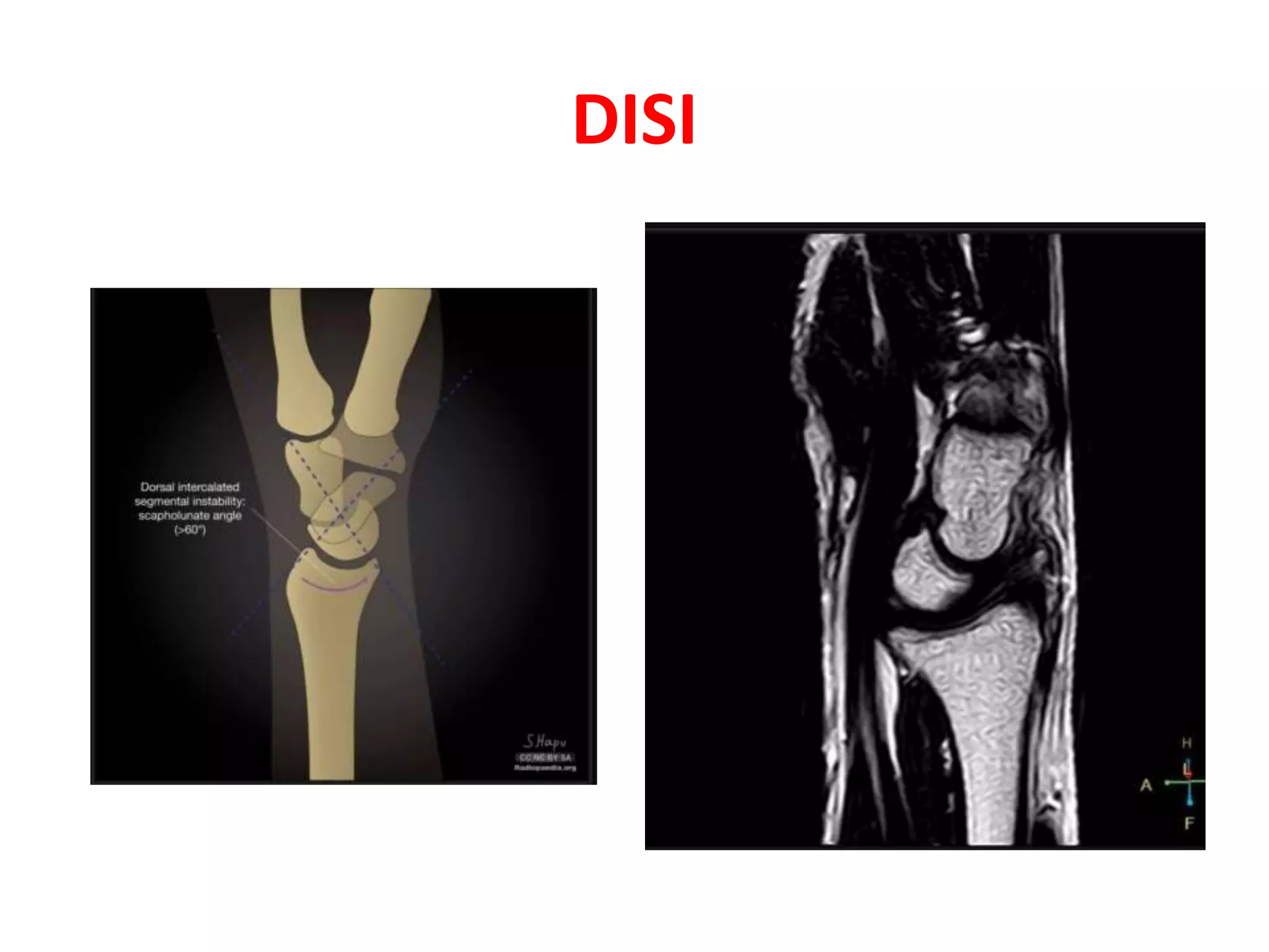 Imaging of wrist joint | PPTX