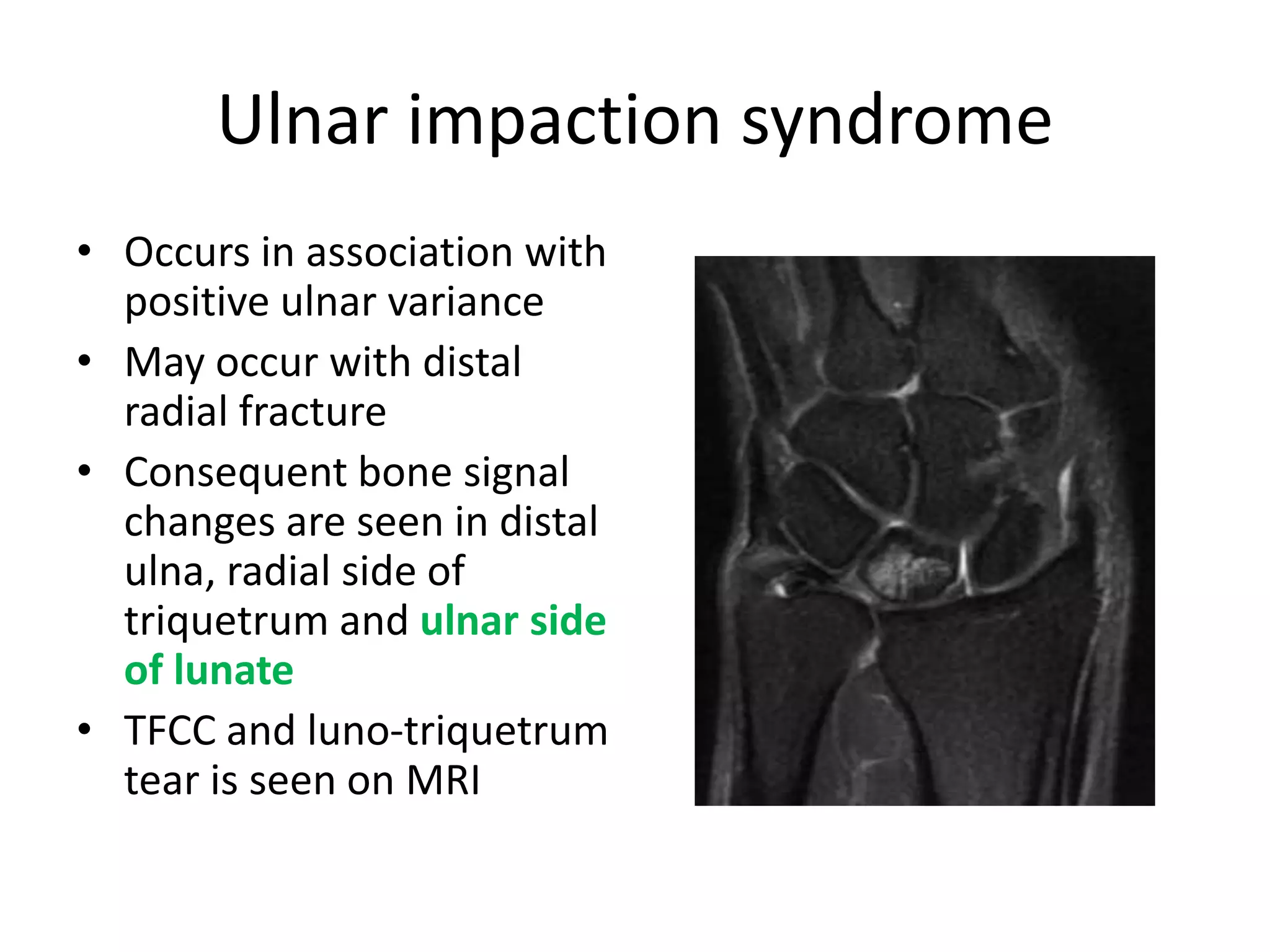 Imaging of wrist joint | PPTX