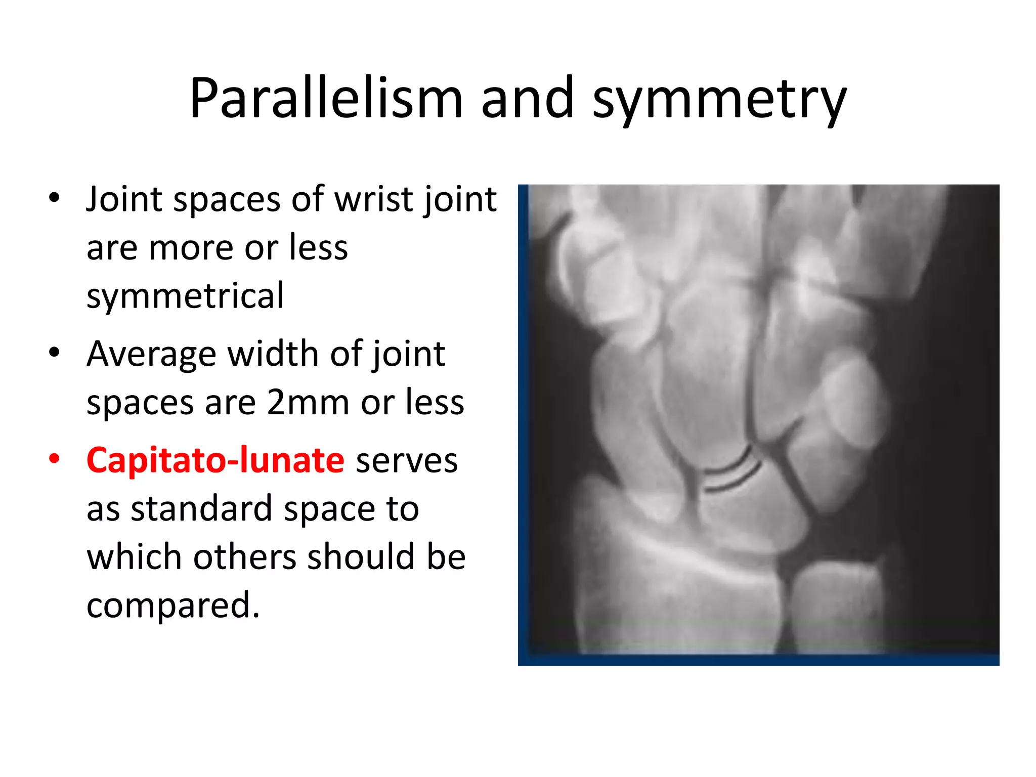 Imaging of wrist joint | PPTX