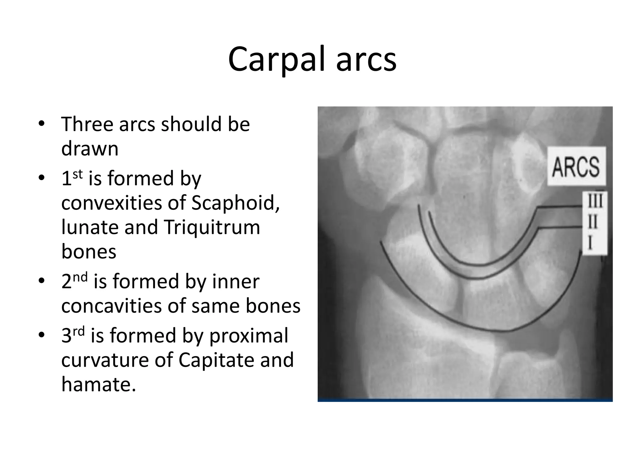 Imaging of wrist joint | PPTX